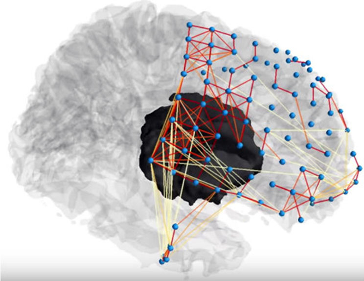 Penn Researchers Use Network Science to Help Pinpoint Source of ... Penn Researchers Use Network Science to Help Pinpoint Source of ...